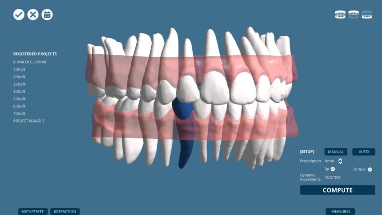 ORTH'UP: cutting-edge clear aligners CAD software at 3,900€